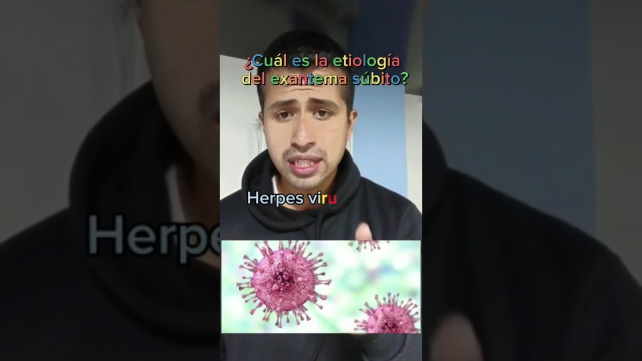 Causa del exantema súbito