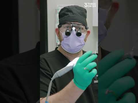 Smile transformation in Las Vegas, NV 😁🙌🏻👀 #3on6 #smiletransformation #fullmouthdentalimplants