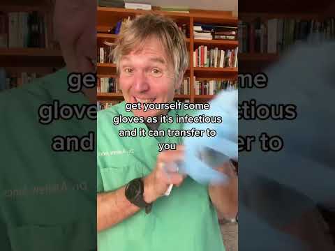 Cat Hair Loss could be Ringworm- this OTC remedy works well!