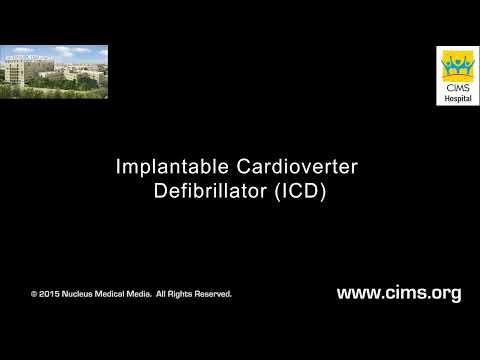 Implantable Cardiac Device | Dr.Dhaval Naik