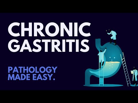 Why You Have Chronic Gastritis: The Pathology of Gastritis