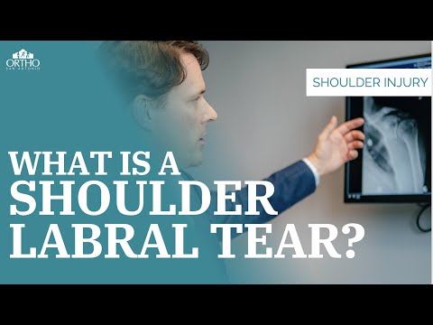 What Is A Shoulder Labral Tear?
