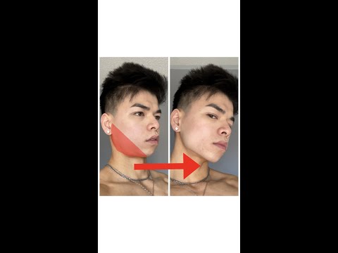 HOW DO I GET A SHARPER JAWLINE WITHOUT SURGERY?