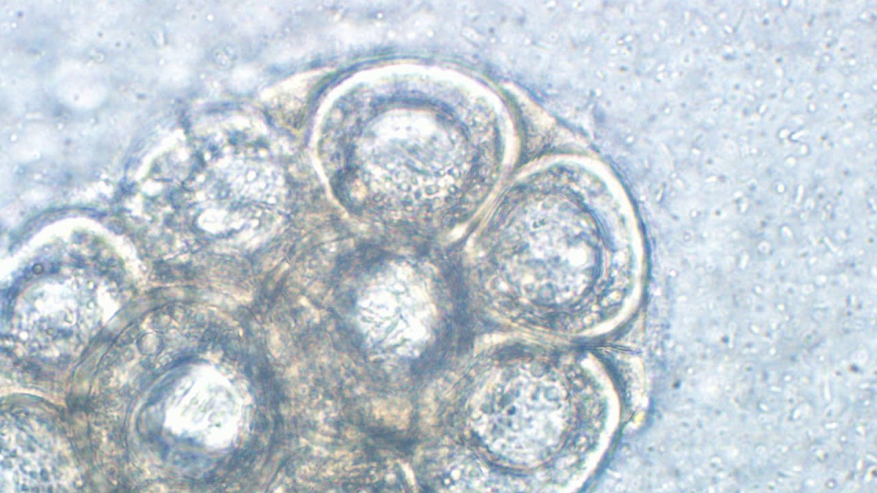 Dipylidium caninum eggs in the egg packet
