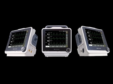 NKV-330 Ventilator Overview: The monitor review windows
