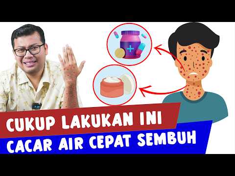 GEJALA PENYEBAB DAN CARA MENGATASI CACAR AIR - DOKTER SADDAM ISMAIL