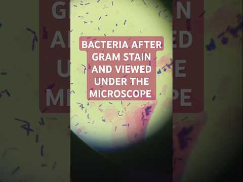 Gram positive bacteria stained purple and Gram negative bacteria stained pink