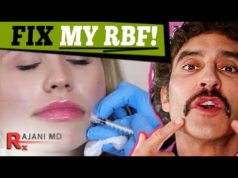 BOTOX FOR THE MOUTH CORNERS // Down Turnd Mouth Fix