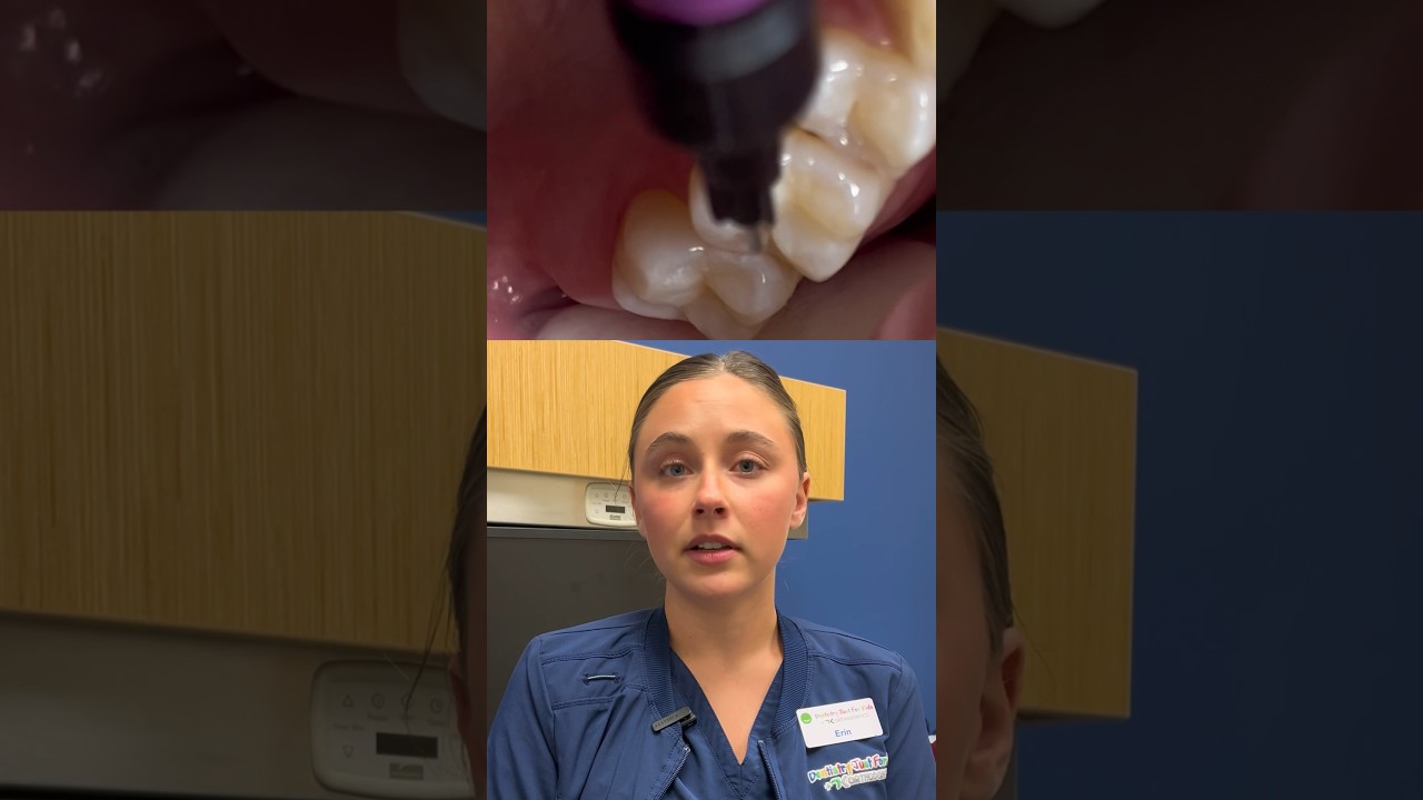 What is a dental sealant? Pediatric dental hygienist explains #dentist #braces #kids
