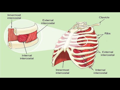 Intercostal Muscle Strain