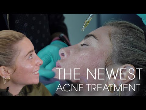 The Newest Way to Treat Maskne, Cycstic Acne, and more!