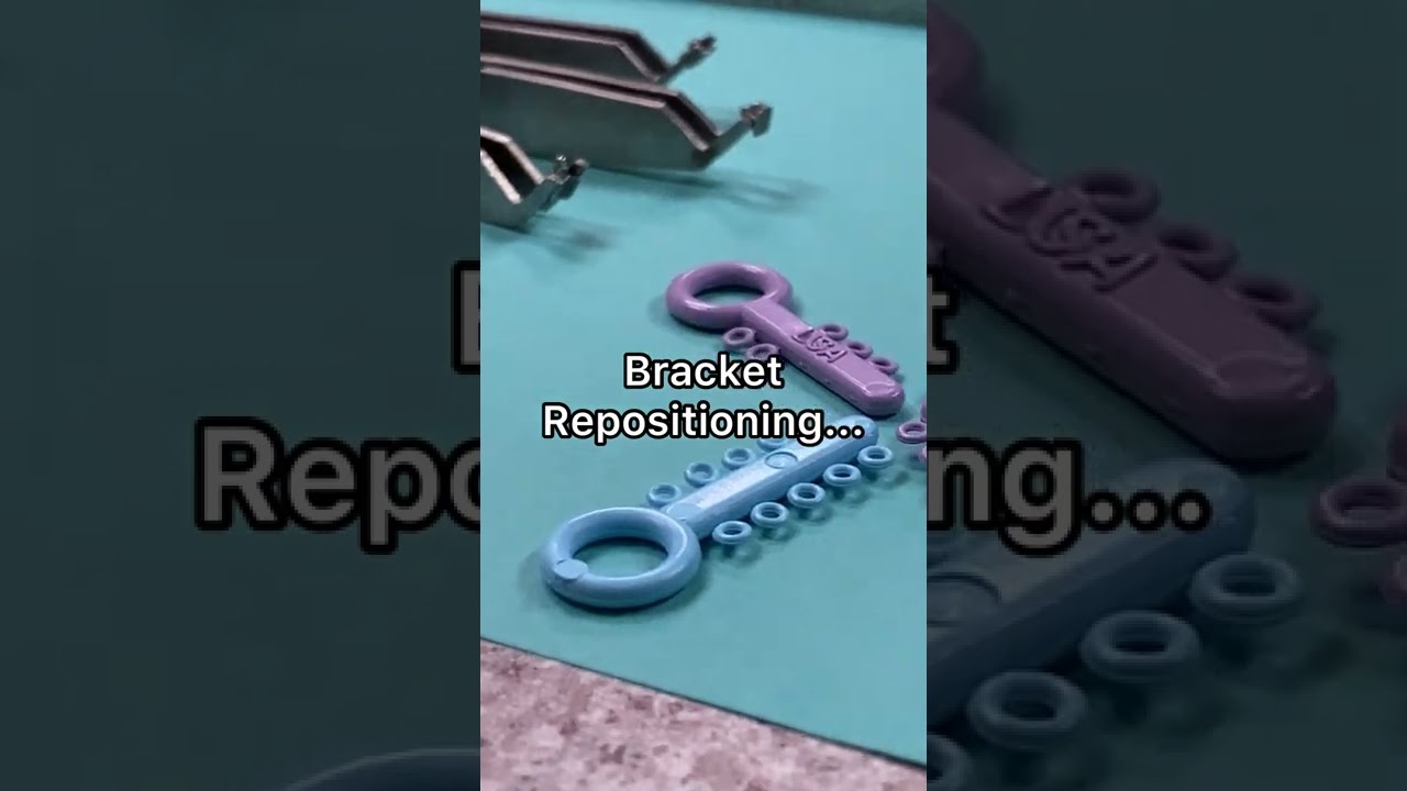 Orthodontic Bracket Repositioning -