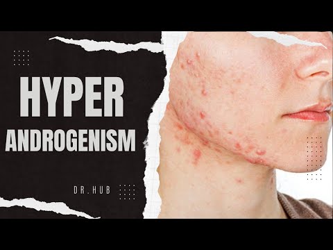 Exam High Yield: Causes of Hyperandrogenism in Pregnancy – Dr Hub