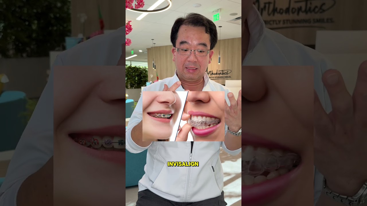 Teeth flaring after Ortho treatment! #orthodontist #braces #invisalign #teeth #orthotips