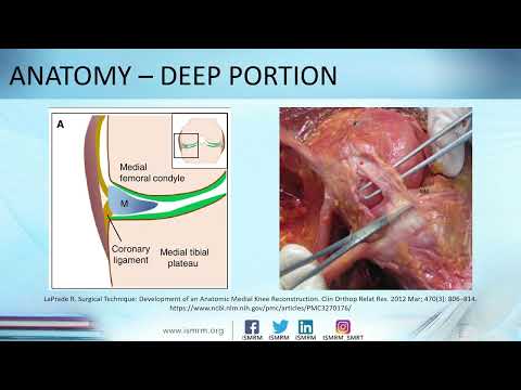 ISMRM MR Academy: How to Read Knee MRI: MCL/Posteromedial Corner
