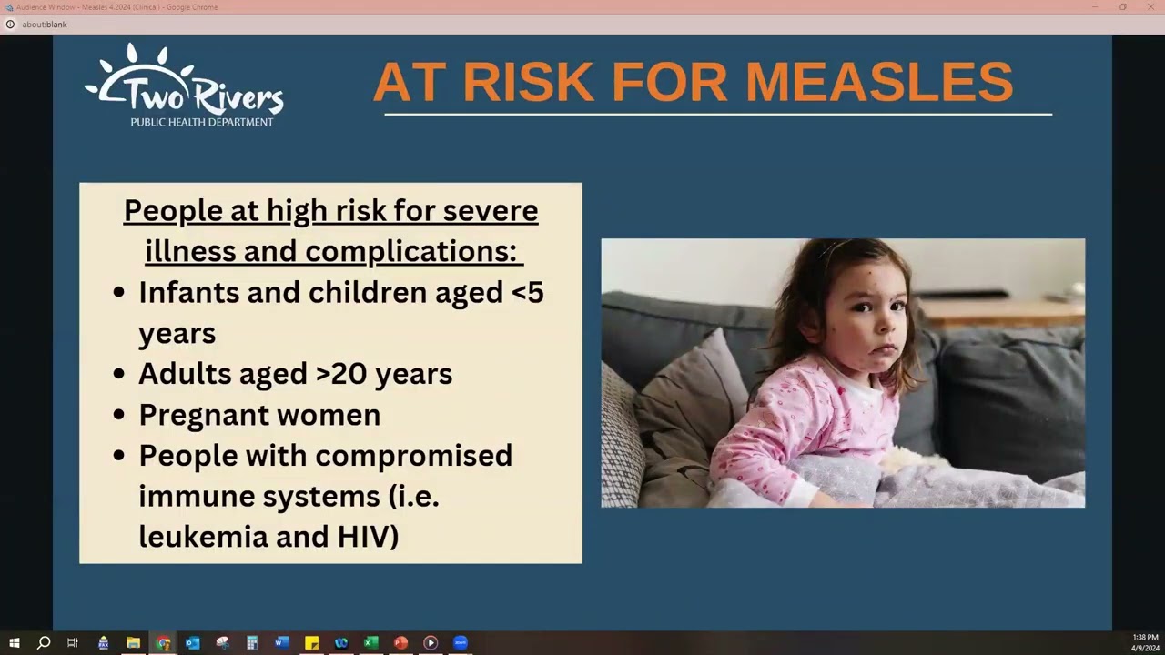 Measles Webinar