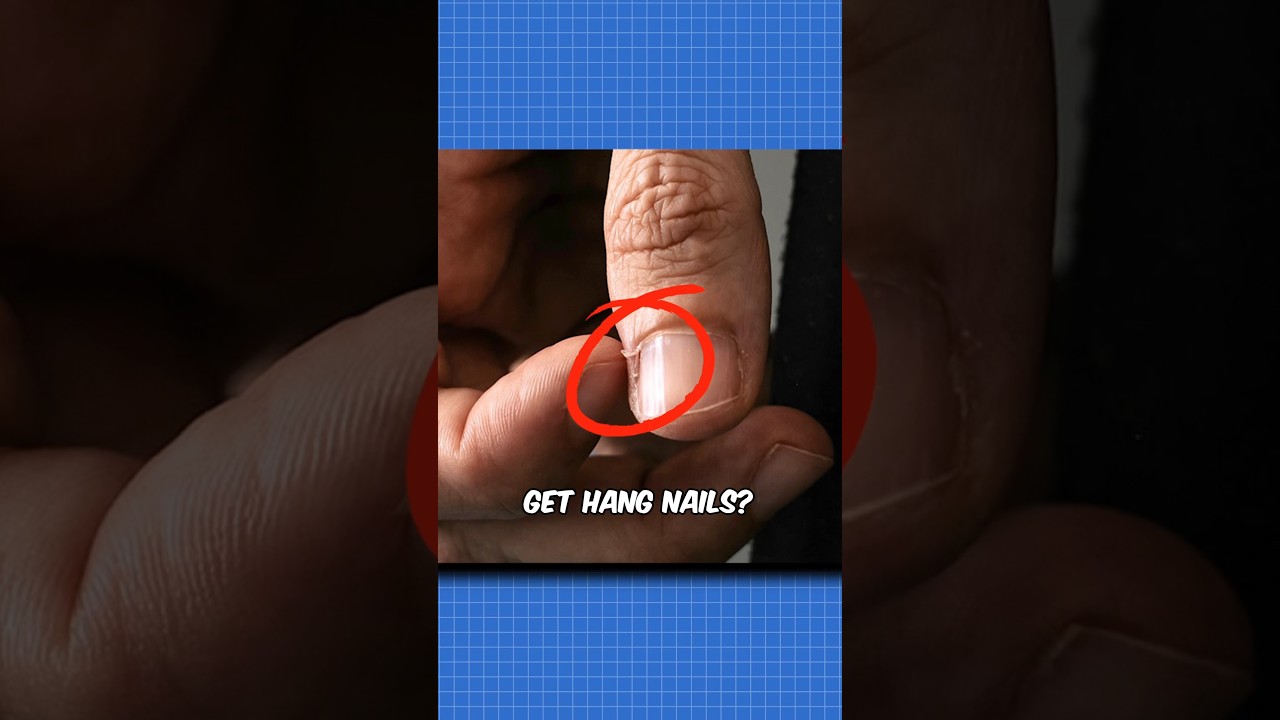 WHY WE GET HANGNAILS | 😨 (Explained) #facts #knowledge