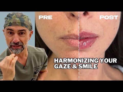 Harmonizing Your Gaze & Smile: Unlock the Secret to Expressive Beauty