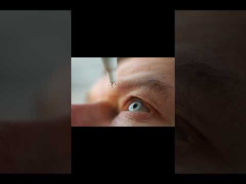 What OTC drops can help redness from glaucoma drops?