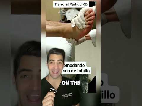 Ankle Reduction