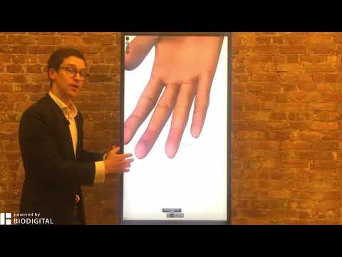 What is Raynaud's phenomenon? - Dr. Tom Talks