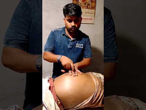 Ascitic Fluid in Abdomen // Free Fluid in Abdominal Cavity