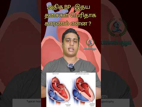 அதிக BP இருந்த இதய தசைகள் பெரிதாக காரணம்| Left ventricular hypertrophy in Hypertension #lvh #echo
