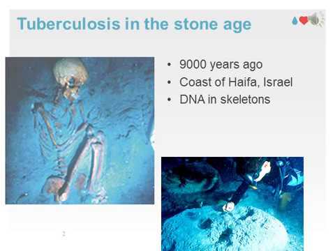 Lecture 01 TB history