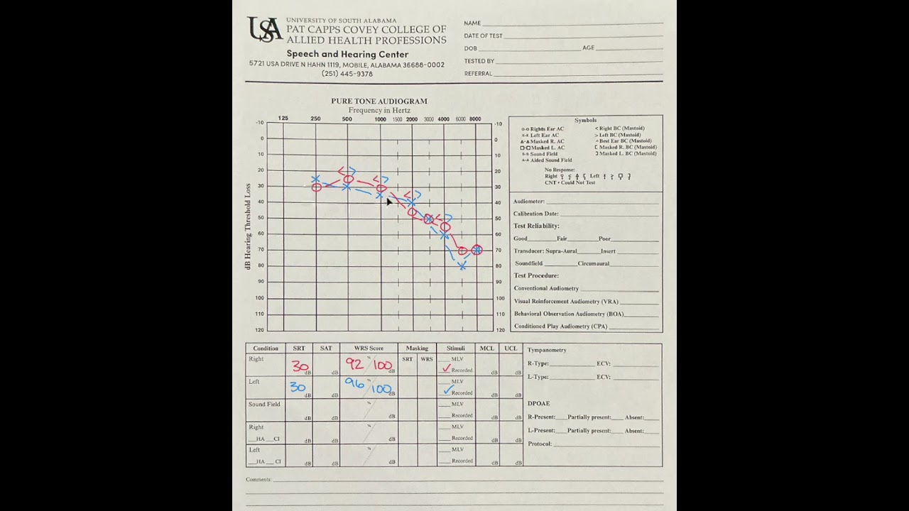 How to Explain an Adult Audiogram (Dr. Redding)