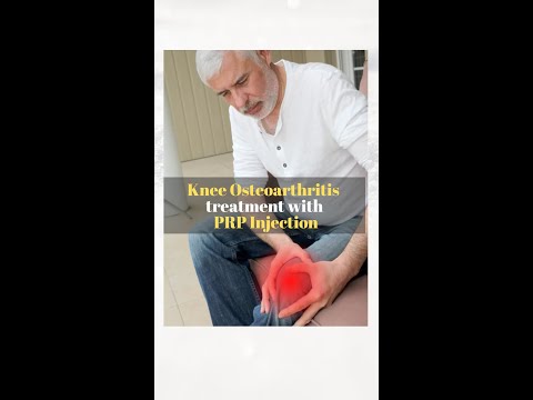 Knee #osteoarthritis treatment with #PRP Injection #recovery #askdrmanu