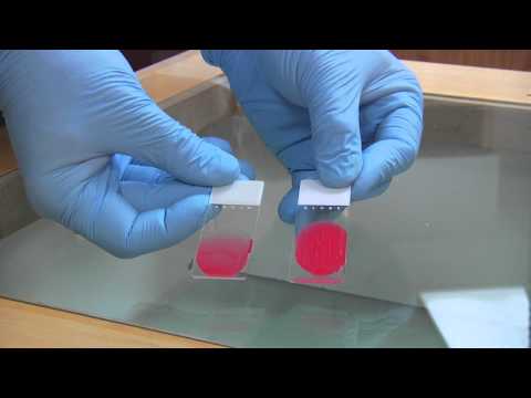 Slide Techniques for Aspirated Material | Incyte Diagnostics' Blog