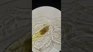 Poop Under Microscope Watch HD Mp4 Video Download Free