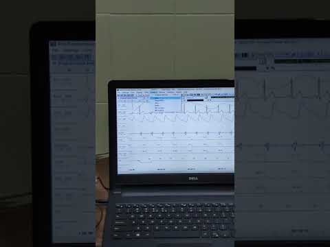 Physiograph at Best Price in India