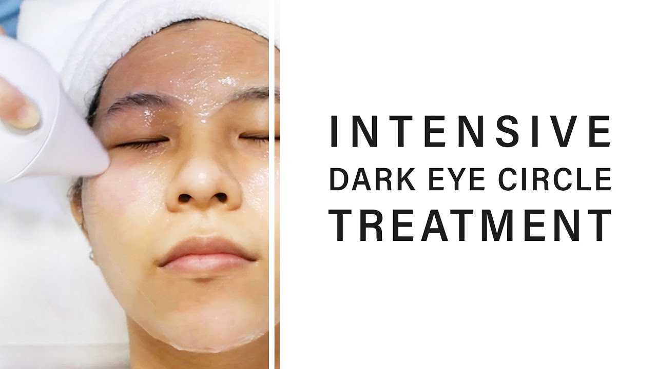 Intensive Dark Eye Circle Treatment | Chrysalis™ Medi-Aesthetic
