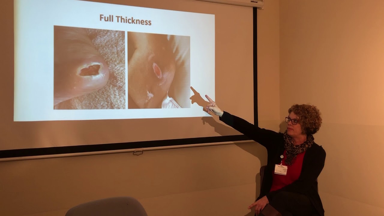 Wound Care Presentation (2018)