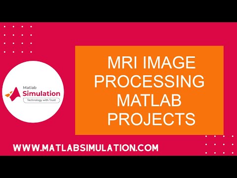 MRI Image Processing Matlab Projects | Brain Tumor Detection using Matlab | MRI image processing
