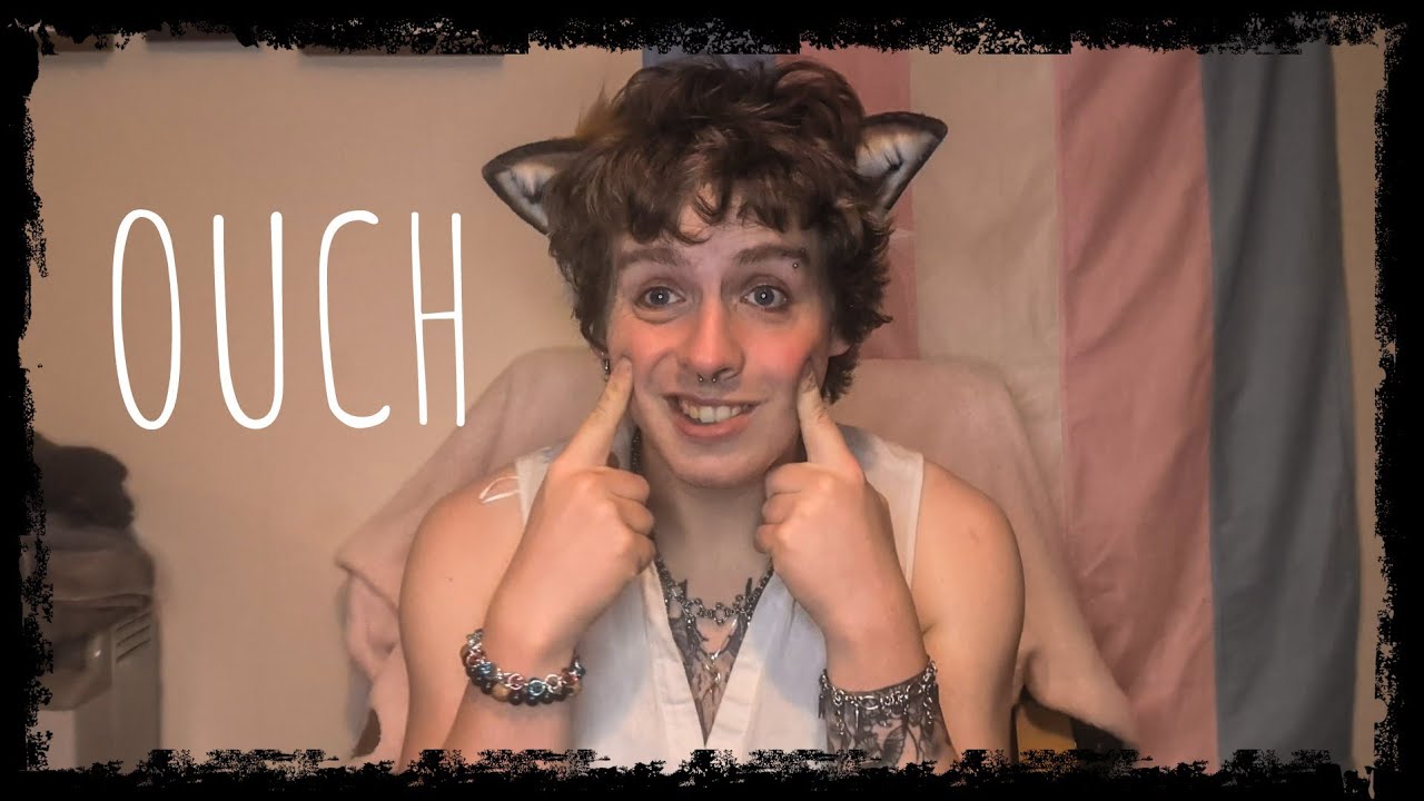 £300 lollypop (this is a video about teeth) [ Trans Girl Daily Vlog 180 ]