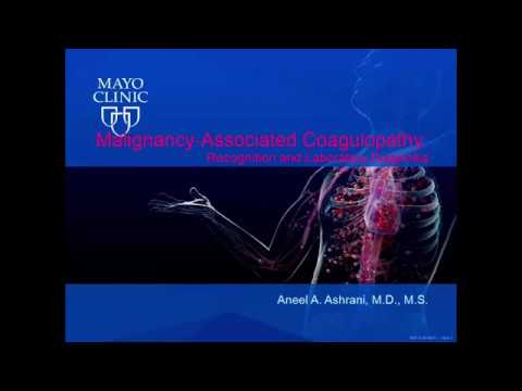 Malignancy-Associated Coagulopathy: Recognition and Laboratory Diagnosis