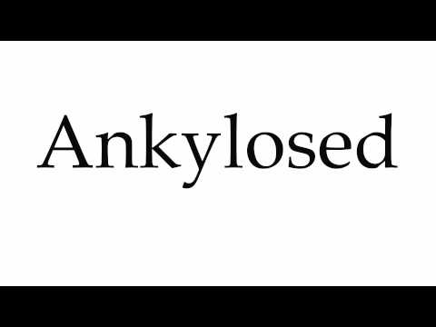 How to Pronounce Ankylosed
