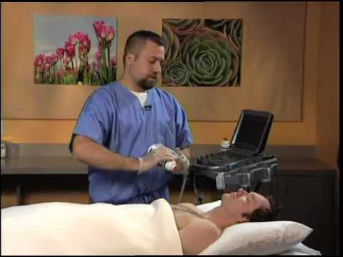 How To: Ultrasound Guided Stellate Ganglion Nerve Block Scanning Technique
