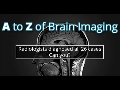 A to Z of brain imaging