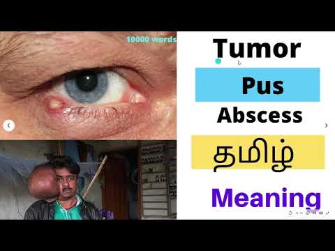 Abscess tamil meaning, Abscess in tamil, Abscess meaning in tamil, Abscess in sentence.