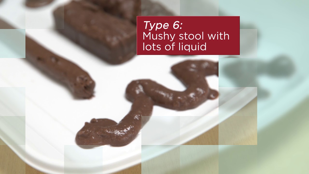 A visual guide to healthy poop