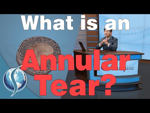 What Is An Annular Tear?