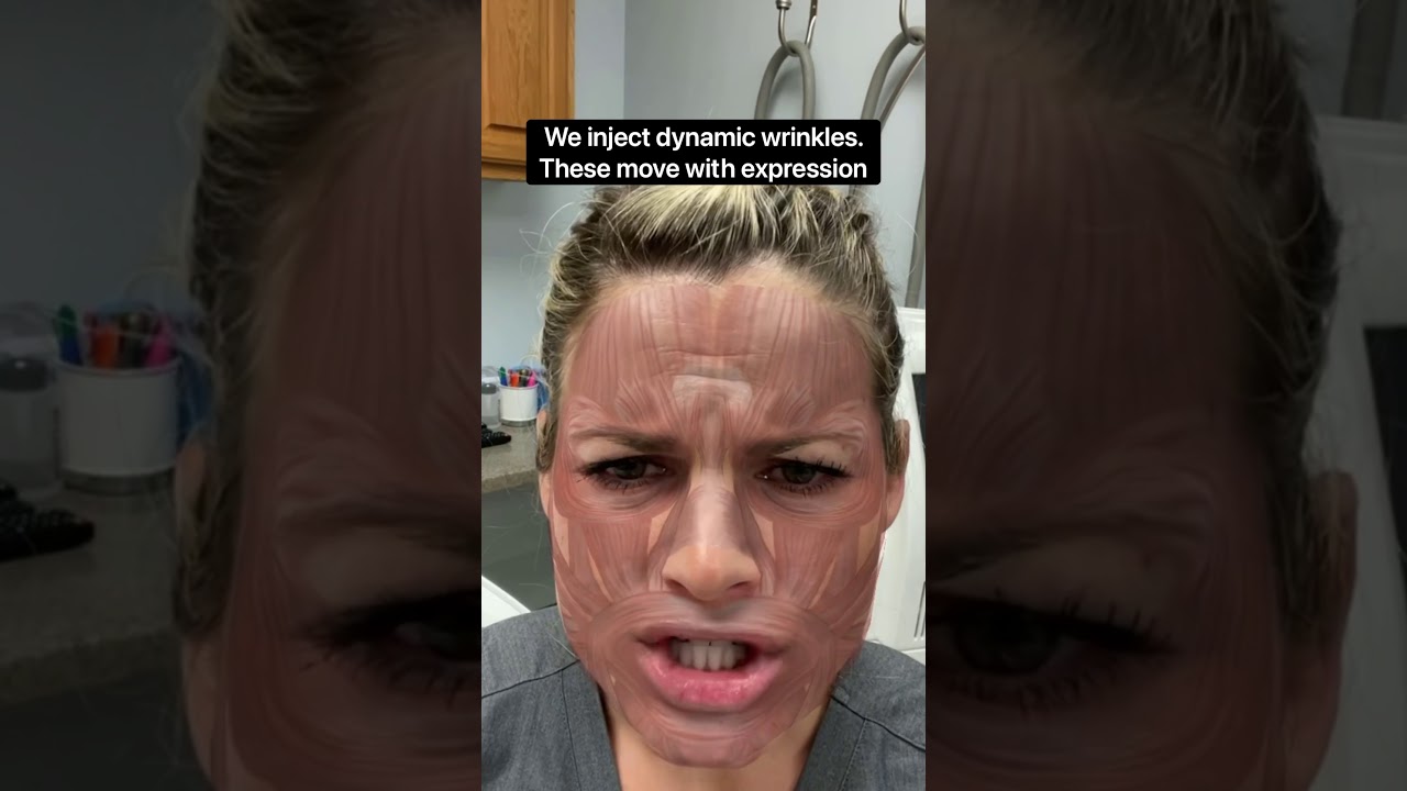 Botox / Dysport Education