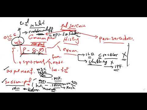 Sarcoidosis 2 : Pulmonary Sarcoidosis,post graduate rheumatology. Dr Mohammed Kamal