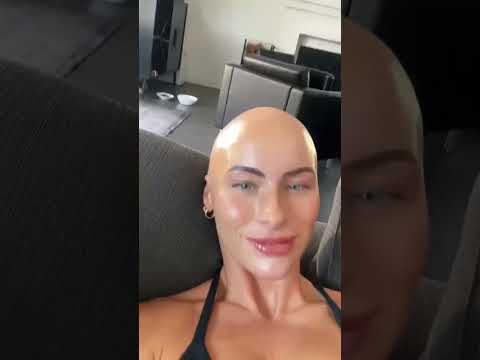 WHAT IN THE ALOPECIA IS GOING ON #hairgrowth #alopecia #alopeciaawareness #bald #hairregrowth