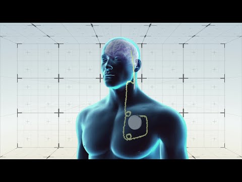 Man responds to nerve stimulation after 15 years in vegetative state