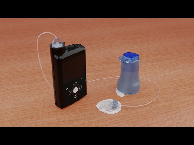 Infusion Set - Fusion First Infusion Set Manufacturer from Jaipur