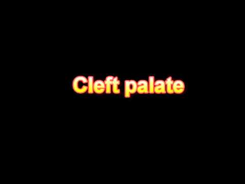 What Is The Definition Of Cleft palate - Medical Dictionary Free Online